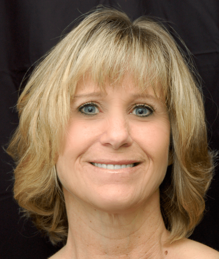 Susan Lowe - DME Expansion Joints